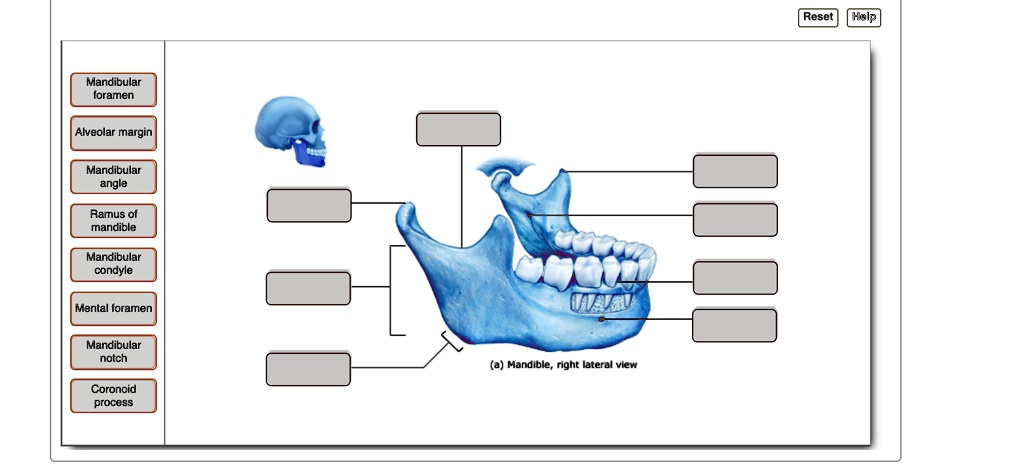 Mandibular foramen Alveolar margin Mandibular angle Ramus of mandible ...
