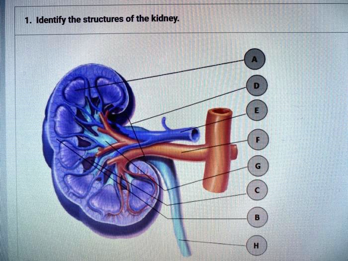 SOLVED: ! Identify the structures of the kidney