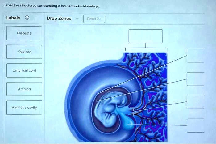SOLVED: Label the structures surrounding a late 4-week-old embryo ...