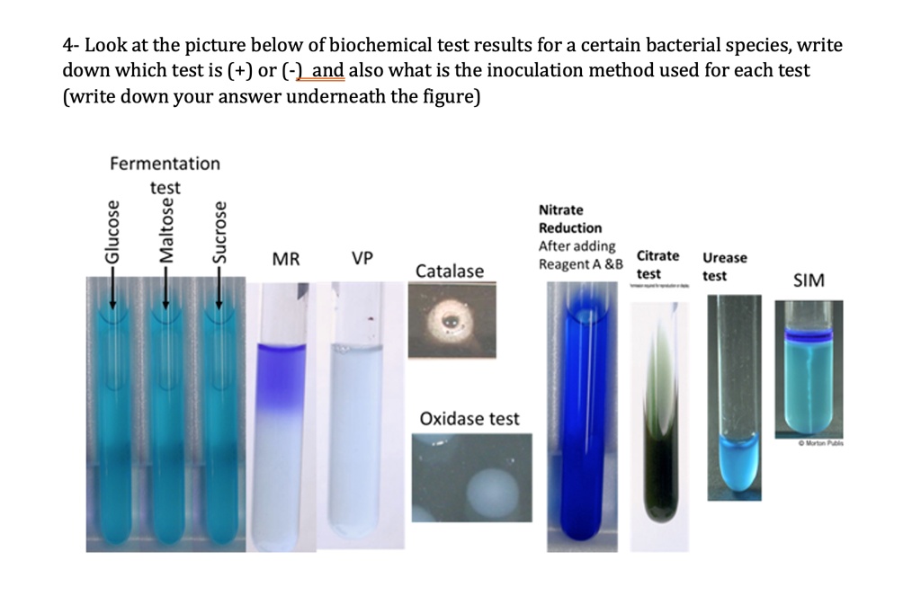 SOLVED: 4- Look at the picture below of biochemical test results for a ...