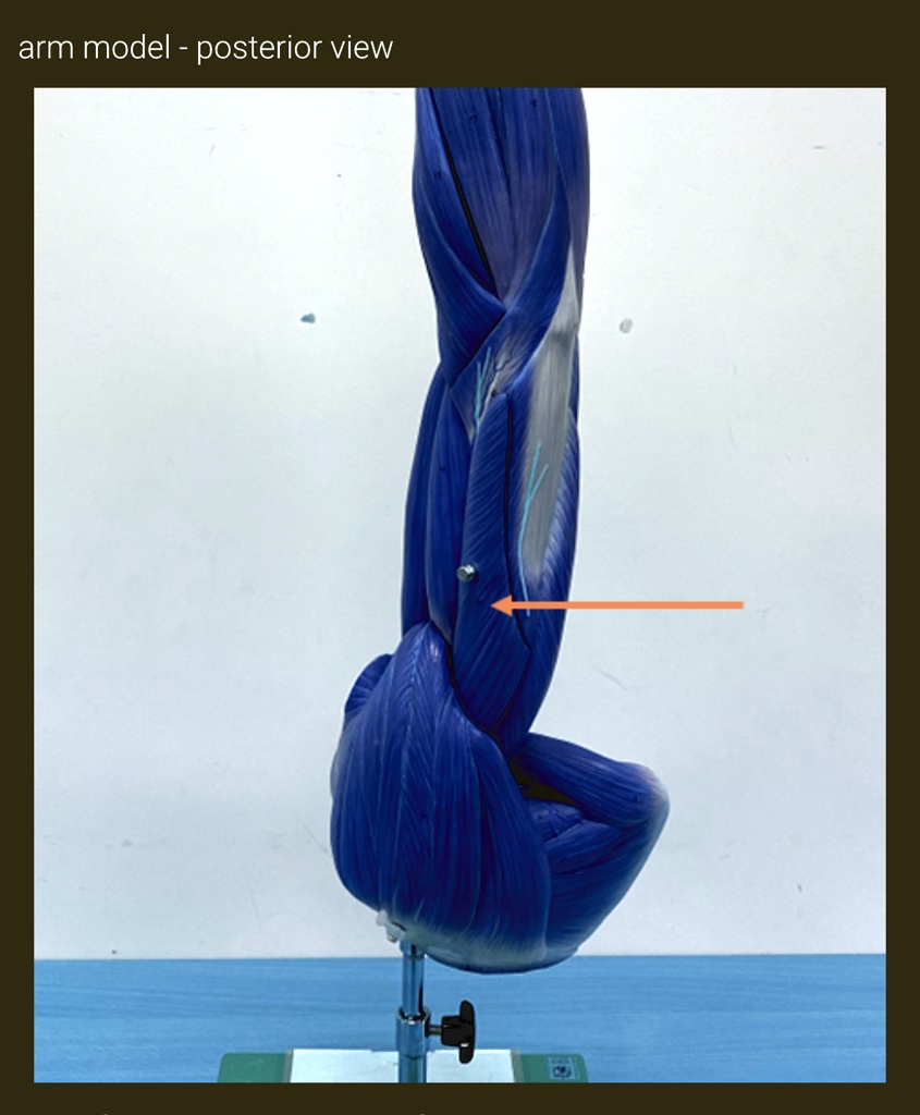 [GET ANSWER] arm model - posterior view