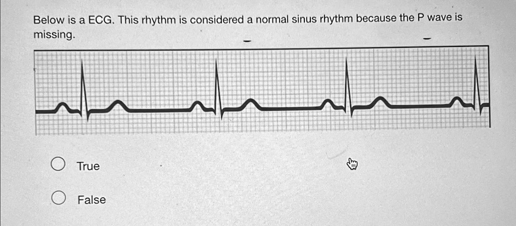 below is a ecg this rhythm is considered a normal sinus rhythm because ...