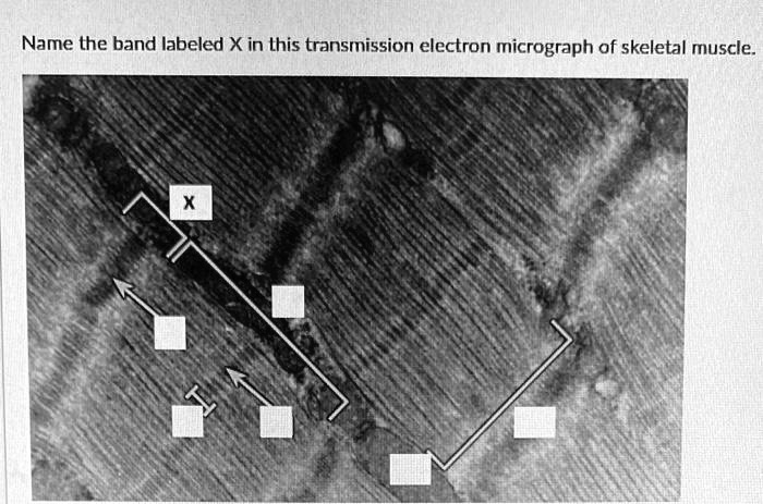SOLVED: name the band labeled X Name the band labeled X in this ...
