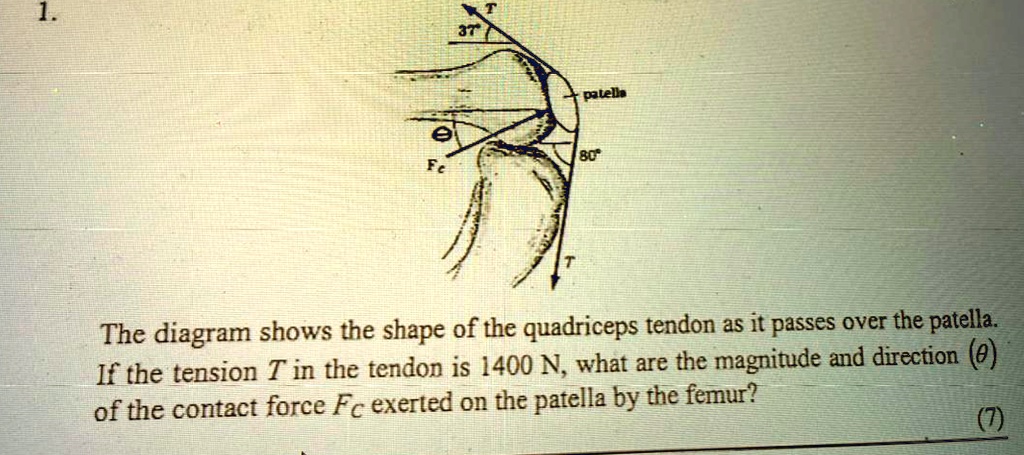 1. 37° patella 80° Fc The diagram shows the shape of the quadriceps ...