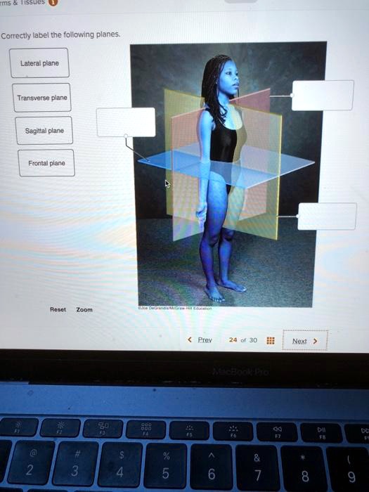 SOLVED: RMS Tissues Correctly label the following planes: Lateral plane ...