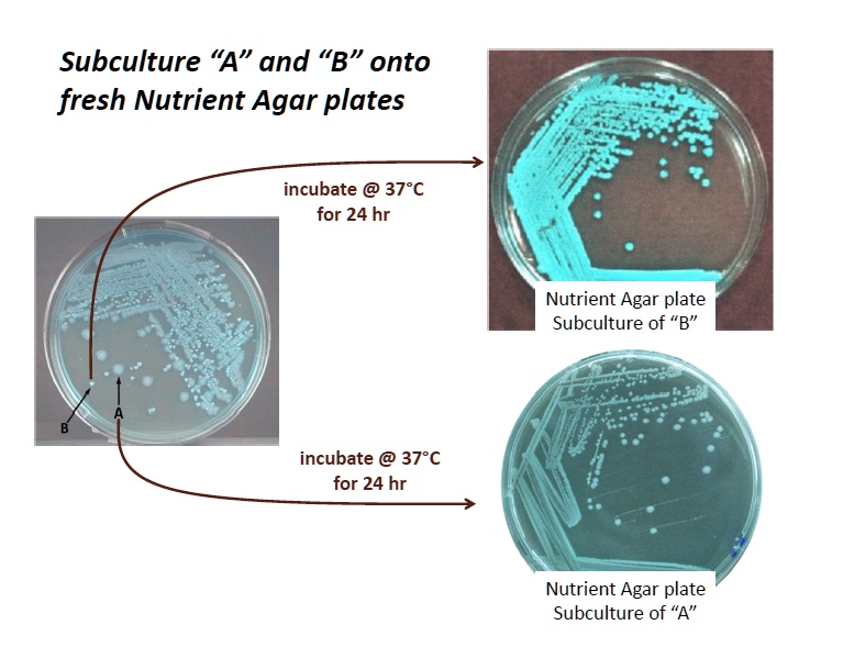 Subculture "A" and "B" onto fresh Nutrient Agar plates incubate @ 37°C ...