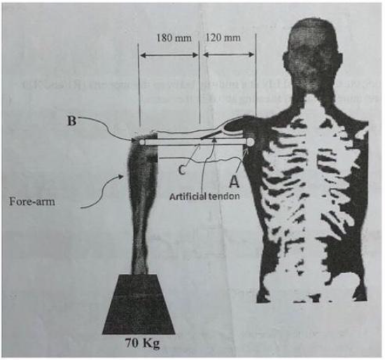 an artificial humorous bone is used in human body as shown in figure ...