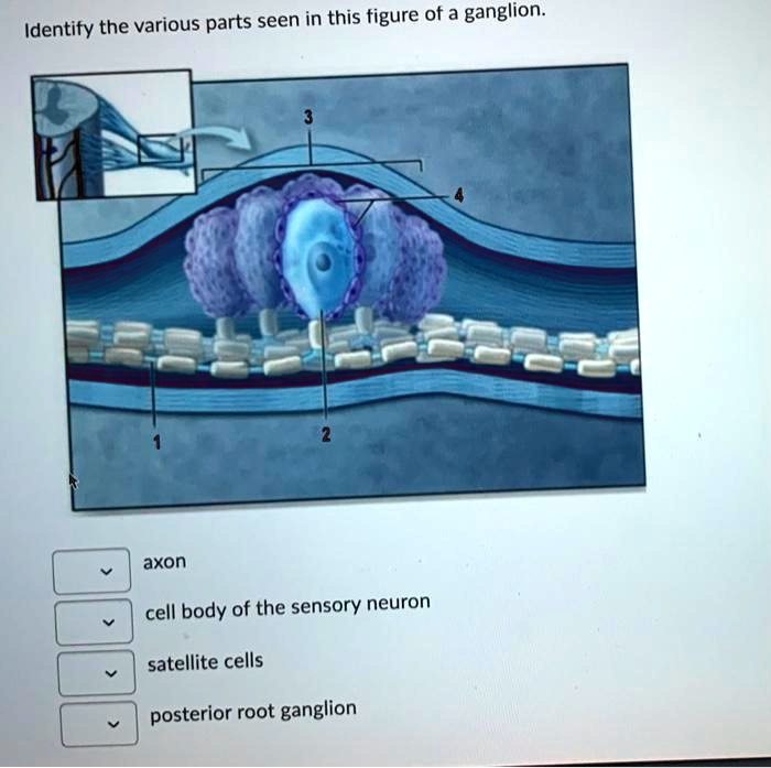 SOLVED: ldentify the various parts seen in this figure of a ganglion ...