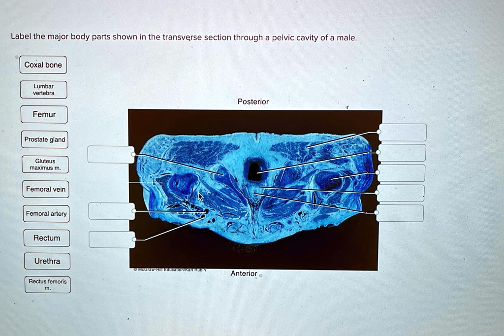 Label the major body parts shown in the transverse section through a ...