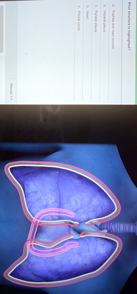What structure is highlighted? A. Trachea and main bronchi B. Visceral ...