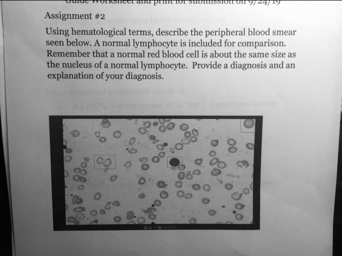 assignment 2 using hematological terms describe the peripheral blood ...