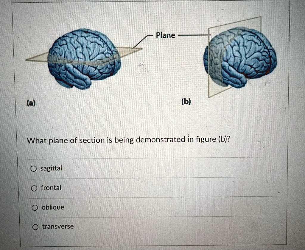 (a) Plane (b) What plane of section is being demonstrated in figure (b ...