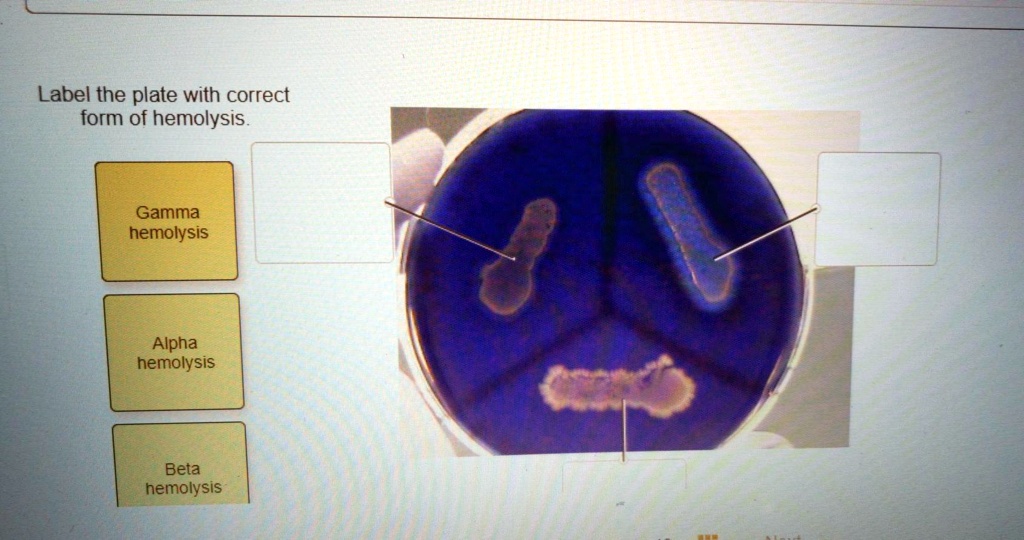 [GET ANSWER] label the plate with correct form of hemolysis gamma ...