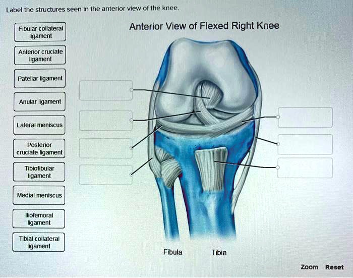 SOLVED: Label the structures seen in the anterior view of the knee ... SOLVED: Label the structures seen in the anterior view of the knee ...