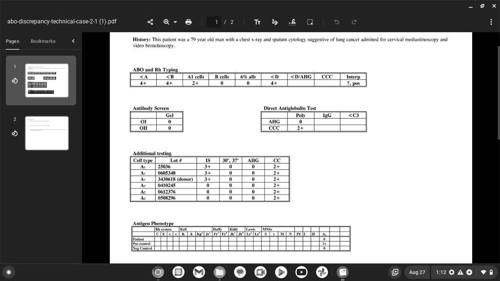 abo-discrepancy-technical-case-2-1 (1).pdf Pages Bookmarks