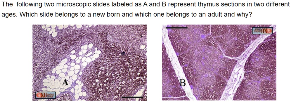 SOLVED: The following two microscopic slides labeled as A and B ...