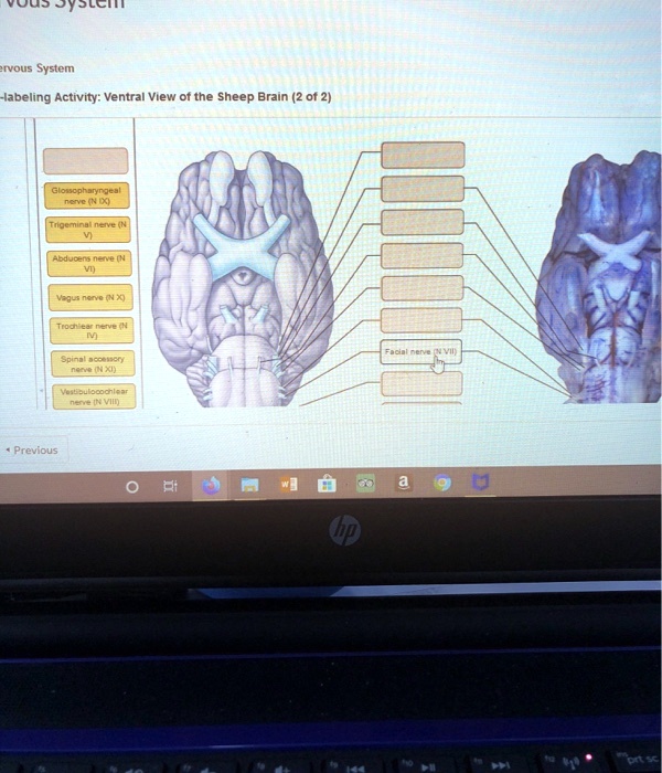 System ervous System -labeling Activity: Ventral View of the Sheep Brain (2 of 2 ...