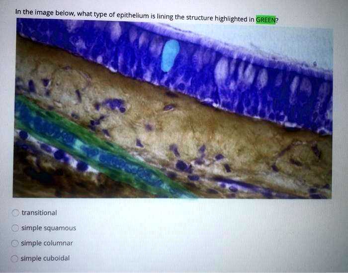 SOLVED: In the image below; what type of epithelium is lining the structure highlighted in GREEN ...