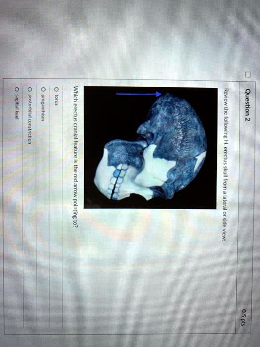 SOLVED: Opostorbital constriction, Prognathism, Torus. Which erectus ...