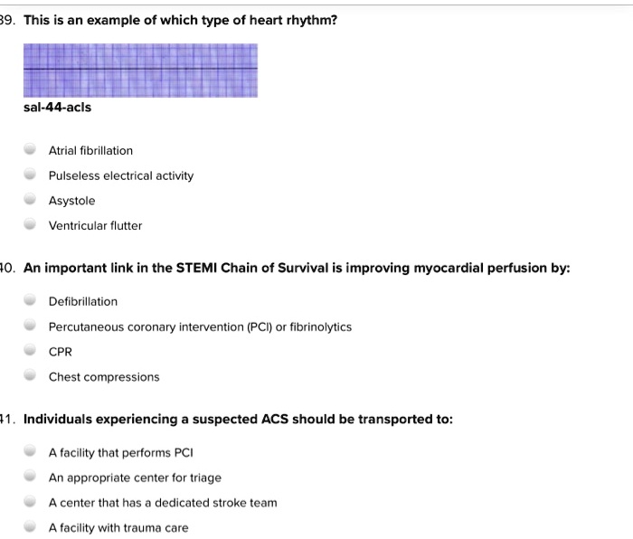 SOLVED: 39. This is an example of which type of heart rhythm? sal-44 ...