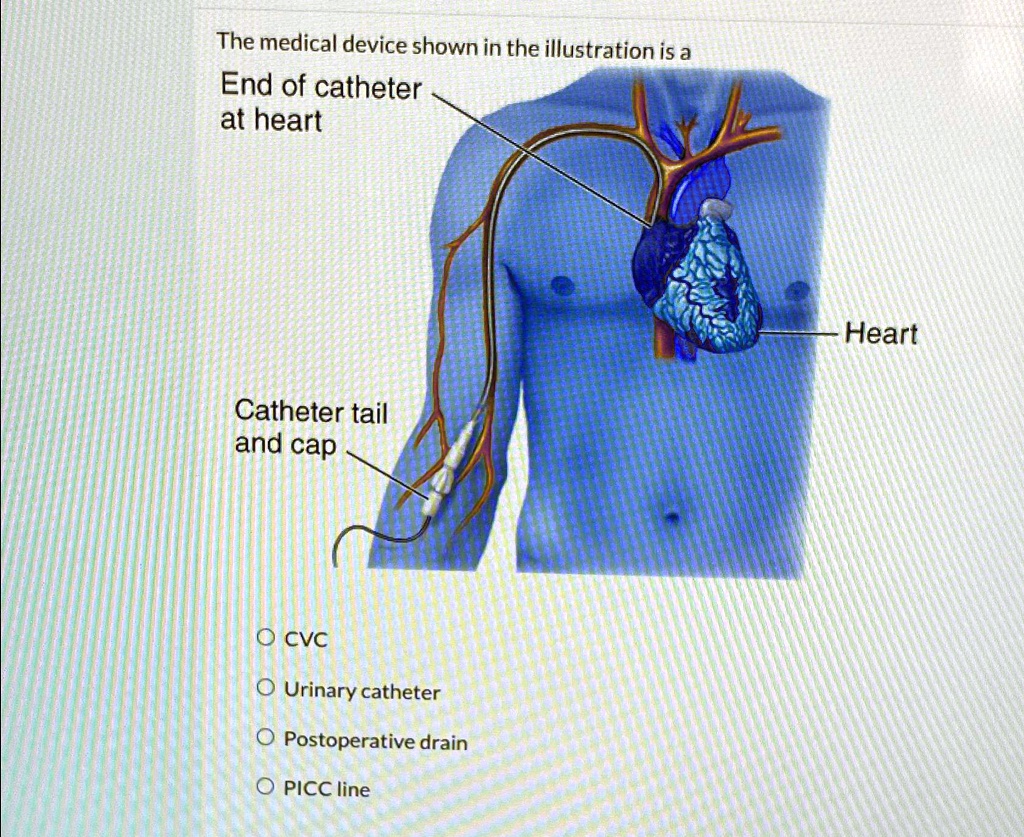 the medical device shown in the illustration is a cvc urinary catheter ...