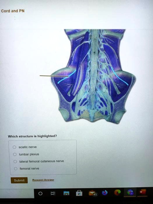 Cord and PN Which structure is highlighted? sciatic nerve lumbar plexus lateral femoral ...