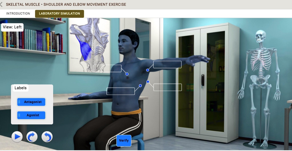 SOLVED: Text: Label the antagonist and agonist for the movement ...