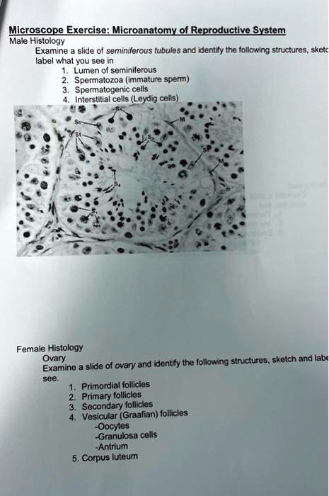 Solved Microscope Exercise Microanatomy Of The Reproductive System