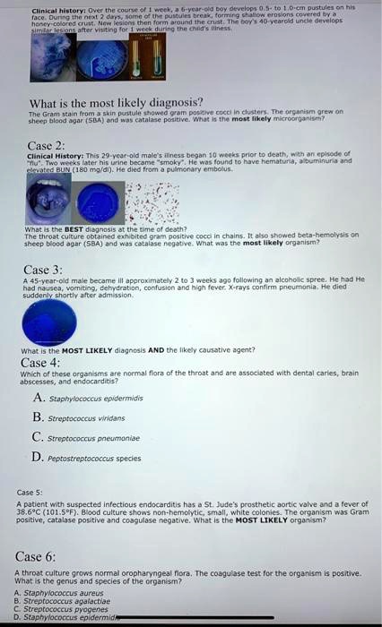 Clinical history: Over the course of 1 week, a 6-year-old boy develops ...