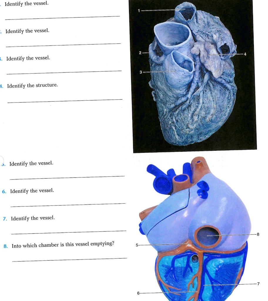 Identify the vessel. Identify the vessel. Identify the vessel. Identify ... Identify the vessel. Identify the vessel. Identify the vessel. Identify ...