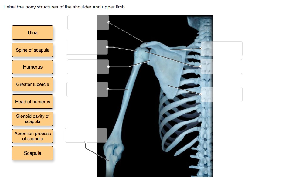 SOLVED: Label the bony structures of the shoulder and upper limb Ulna Spine of scapula Humerus ...