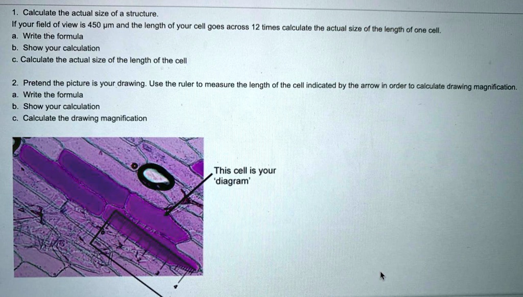 SOLVED: Calculate the actual size of a structure. If your field of view is 450 um and the length ...