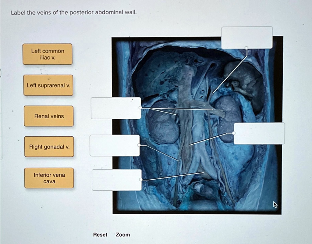 Label the veins of the posterior abdominal wall. Left common iliac v ...