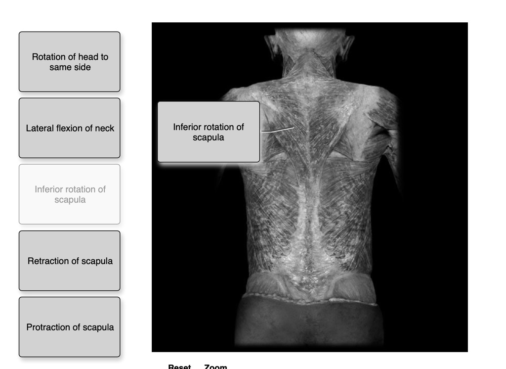 Rotation of head to same side Lateral flexion of neck Inferior rotation ...