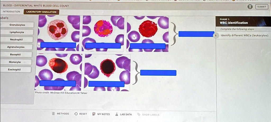 SOLVED: BLOOD - DIFFERENTIAL WHITE BLOOD CELL COUNT BLOOD-DIFFERENTIAL ... SOLVED: BLOOD - DIFFERENTIAL WHITE BLOOD CELL COUNT BLOOD-DIFFERENTIAL ...
