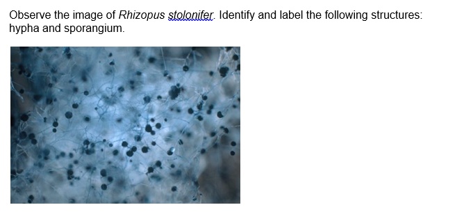 observe the image of rhizopus stoloniter identify and label the ...