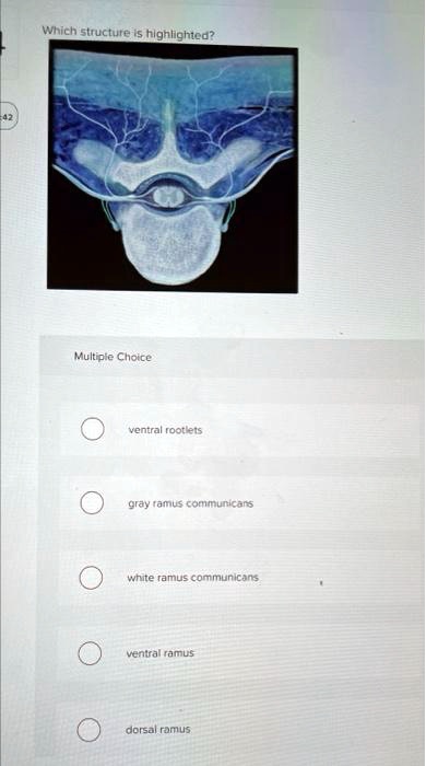 SOLVED: Which structure is highlighted? 42 Multiple Choice ventral rootlets gray ramus ...