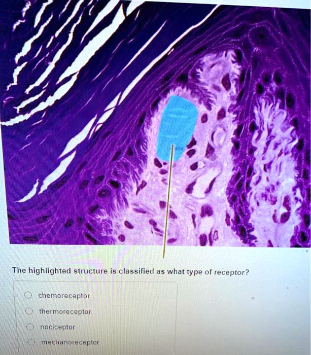 The highlighted structure is classified as what type of receptor ...