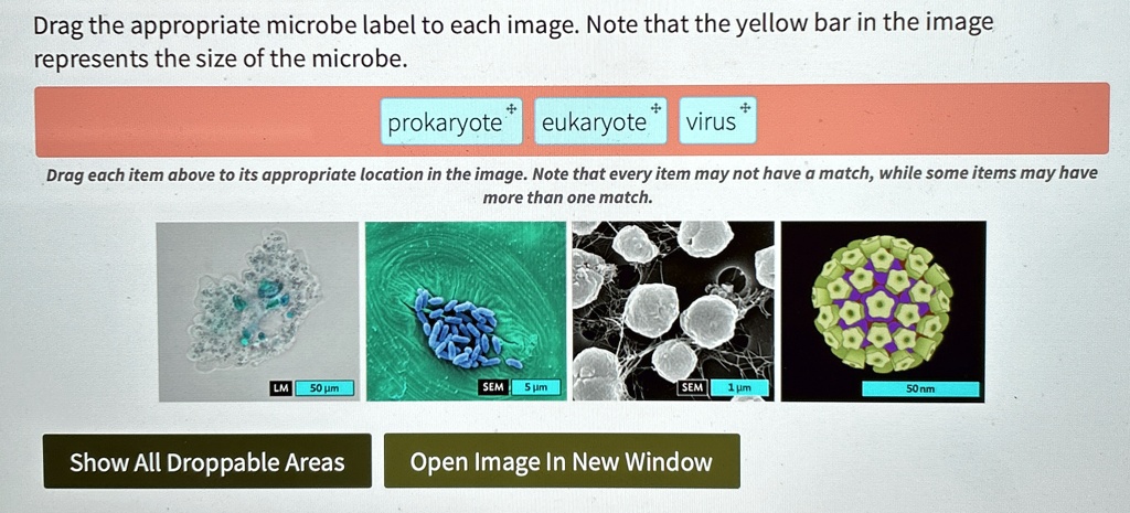 drag the appropriate microbe label to each image note that the yellow ...
