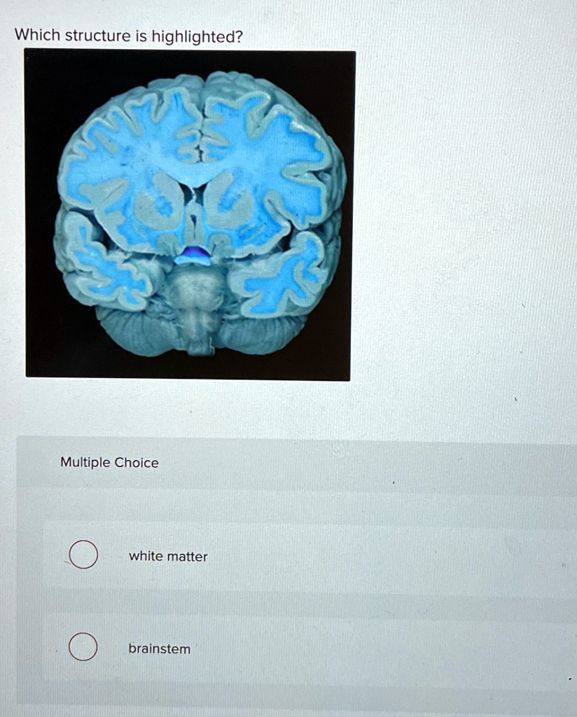 Which structure is highlighted? Multiple Choice white matter brainstem