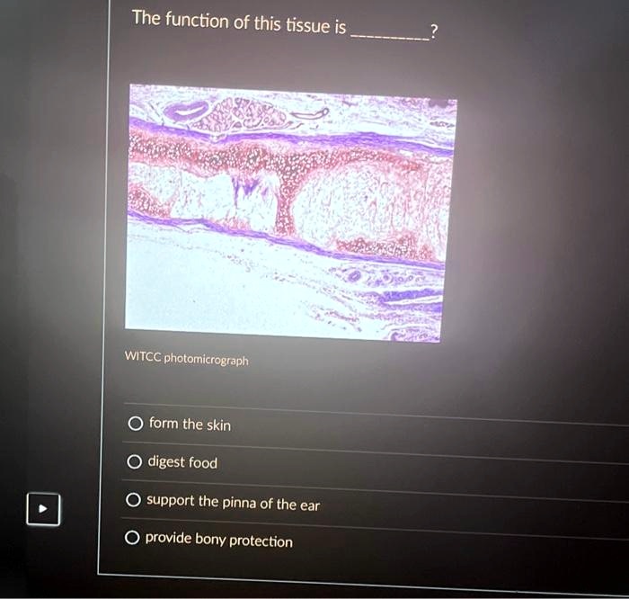 SOLVED: The function of this tissue is to: - form the skin - digest ...