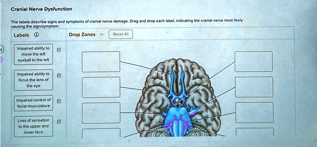 cranial nerve dysfunction the labels describe signs and symptoms of ...