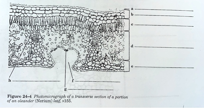 SOLVED: Figure 24-4 Photomicrograph of a transverse section of a ...