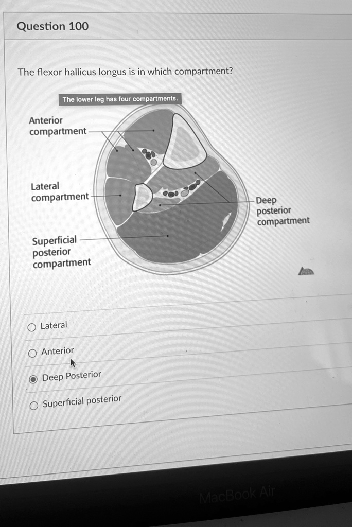 Question 100 The flexor hallicus longus is in which compartment? Lateral Anterior Deep Posterior ...