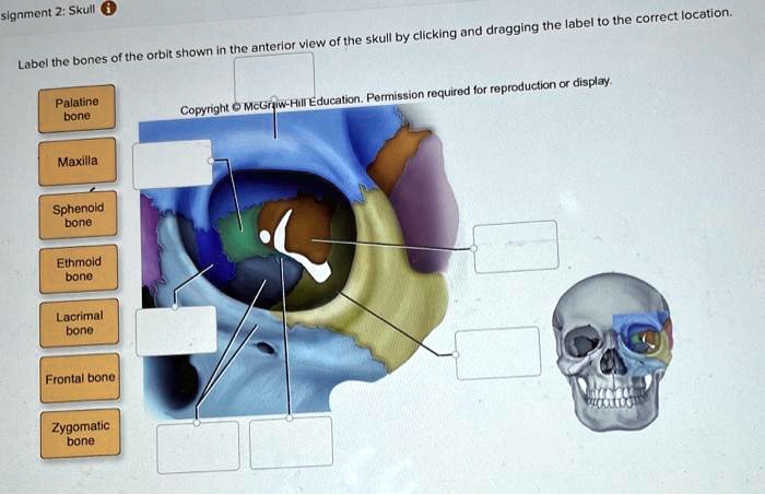 signment 2: Skull Label the bones of the orbit shown in the anterior ...