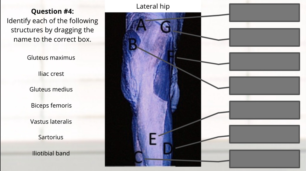 SOLVED: Lateral Hip Question #4: Identify each of the following ...