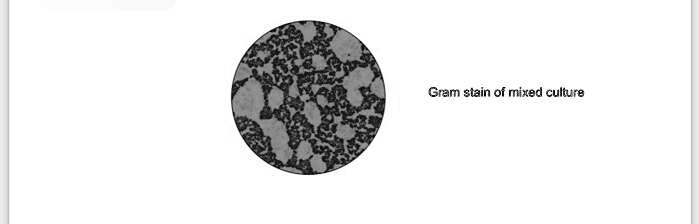SOLVED: Gram-negative possibilities: Interpretation of results for ...