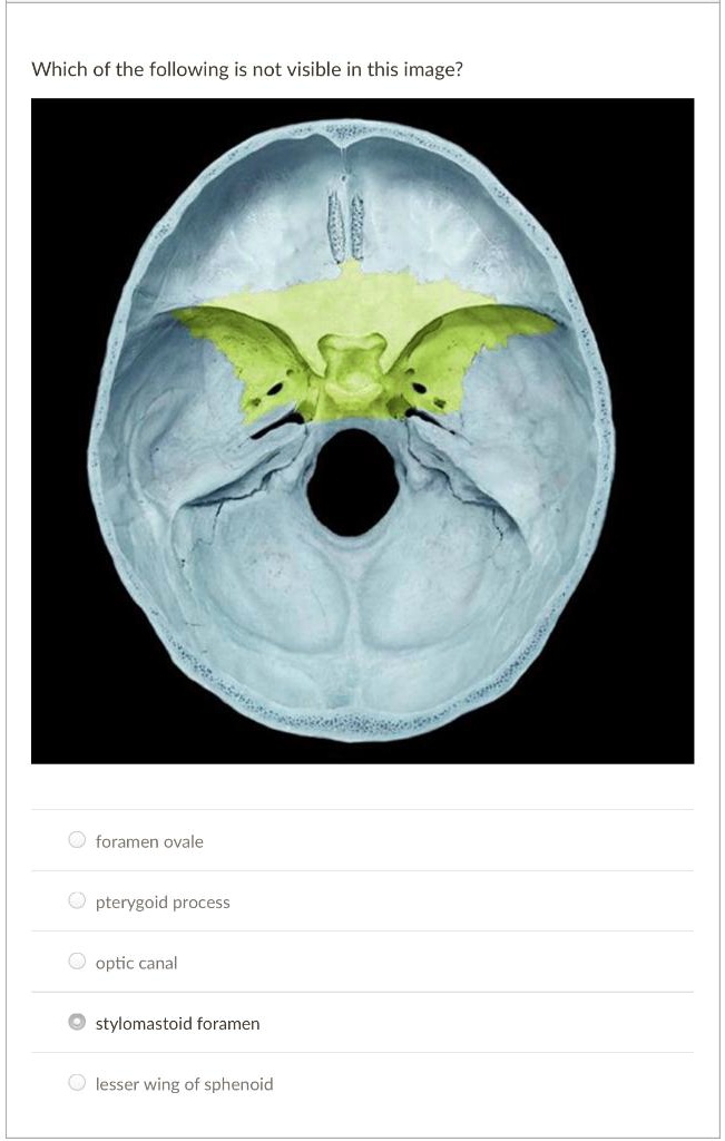 SOLVED: Which of the following is not visible in this image? foramen ...