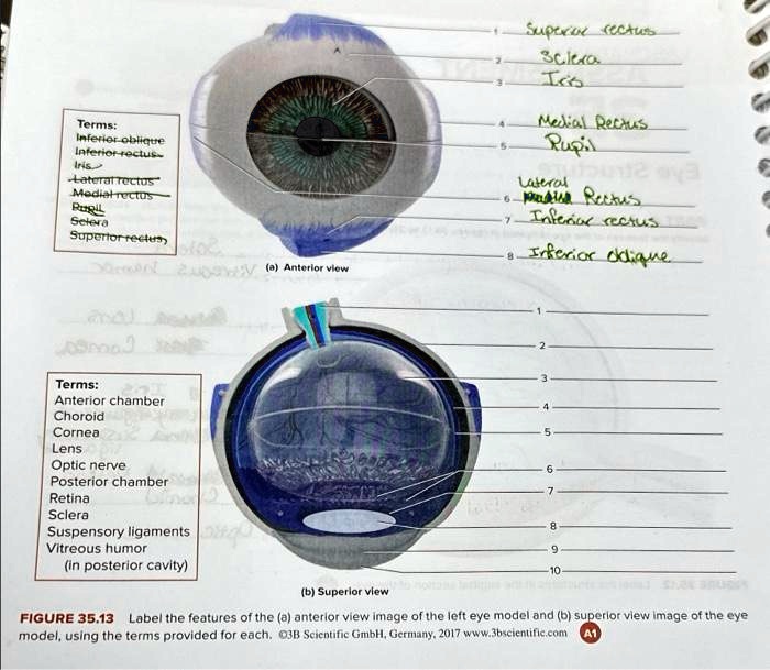 SOLVED: Terms: Inferior oblique, Inferior rectus, Iris, Lateral rectus ...