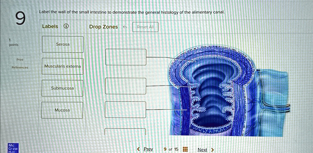 9 1 points Label the wall of the small intestine to demonstrate the ...